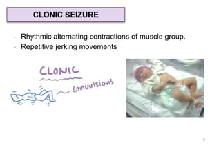 Type and evaluation of seizures | PPT