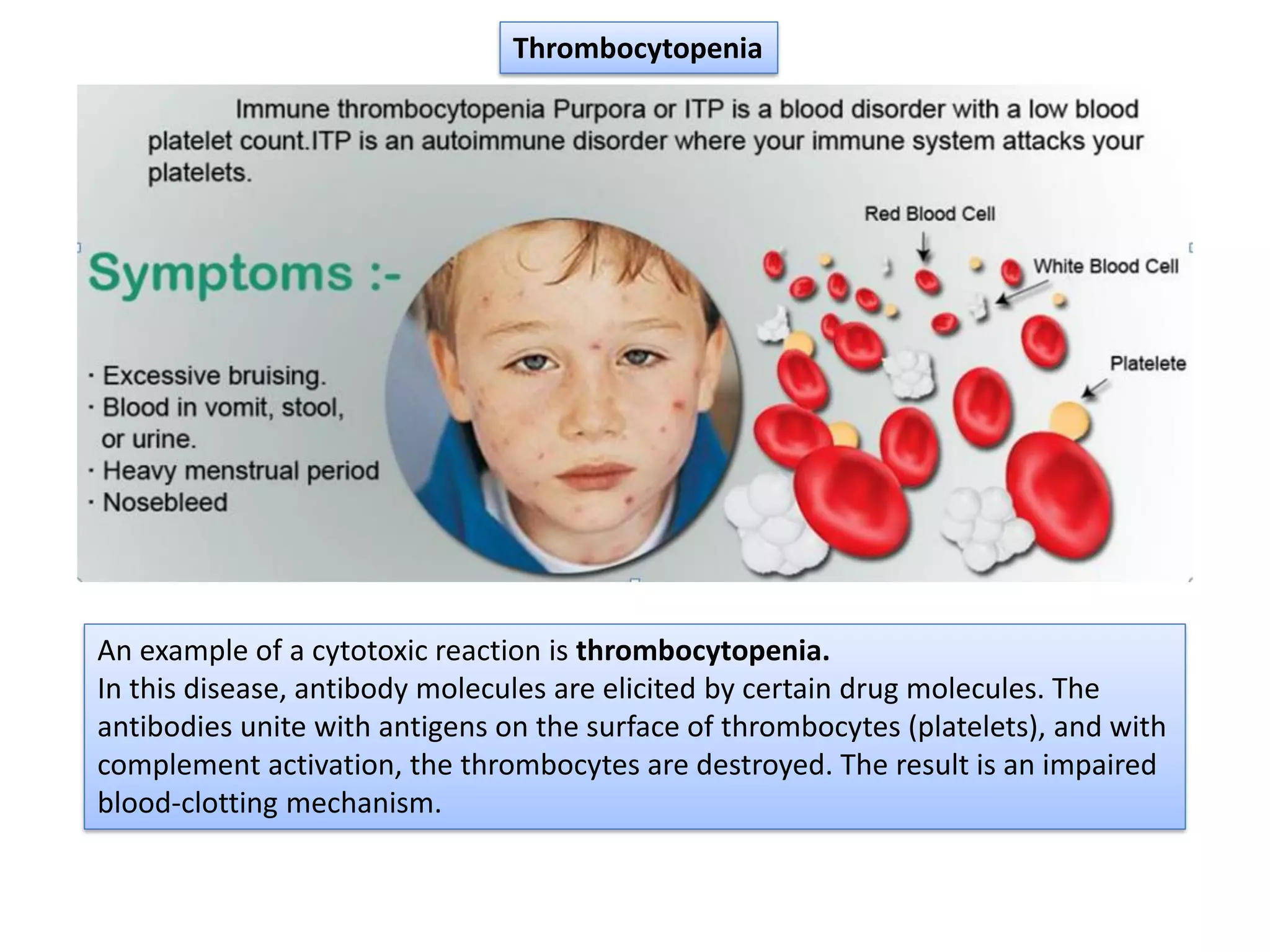 Type II Hypersensitivity-Antibody mediated cytotoxic Hypersensitivity | PDF