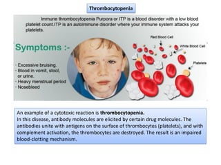 Type II Hypersensitivity-Antibody mediated cytotoxic Hypersensitivity | PDF