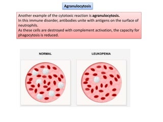 Type II Hypersensitivity-Antibody mediated cytotoxic Hypersensitivity | PDF