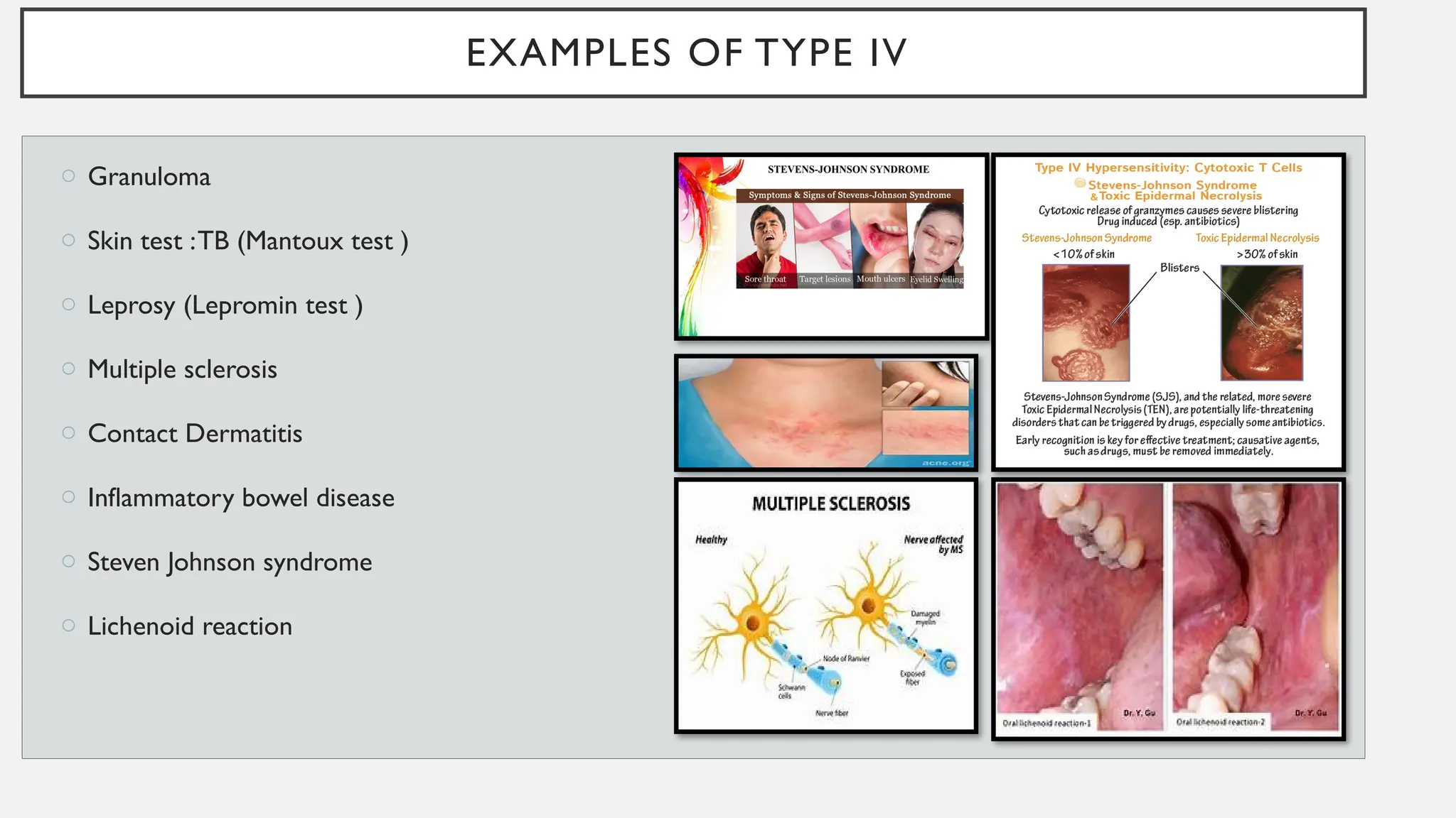 Type II Hypersensitivity Reaction: Mechanism, Examples and Clinical ...
