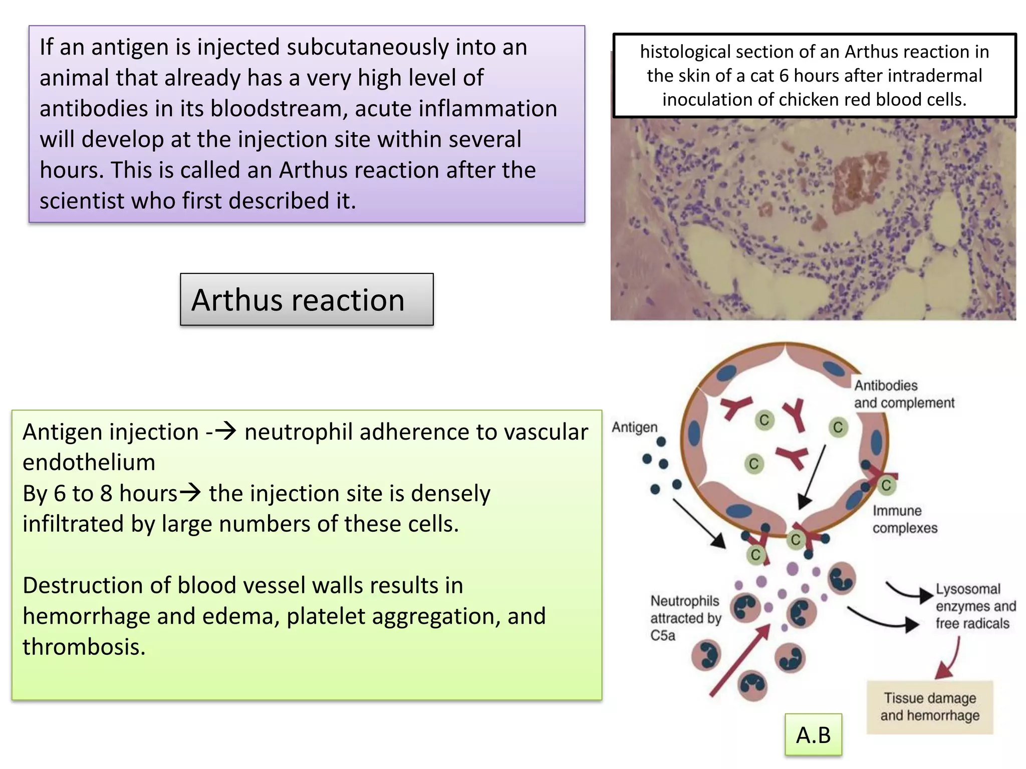 Type Iii Hypersensitivity Pdf 6295