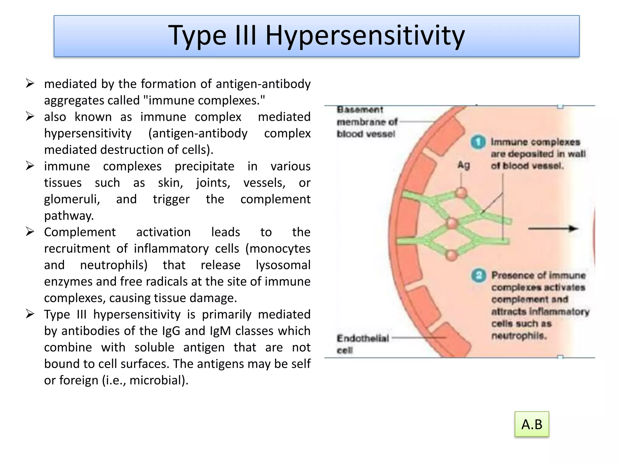 Type III Hypersensitivity | PDF