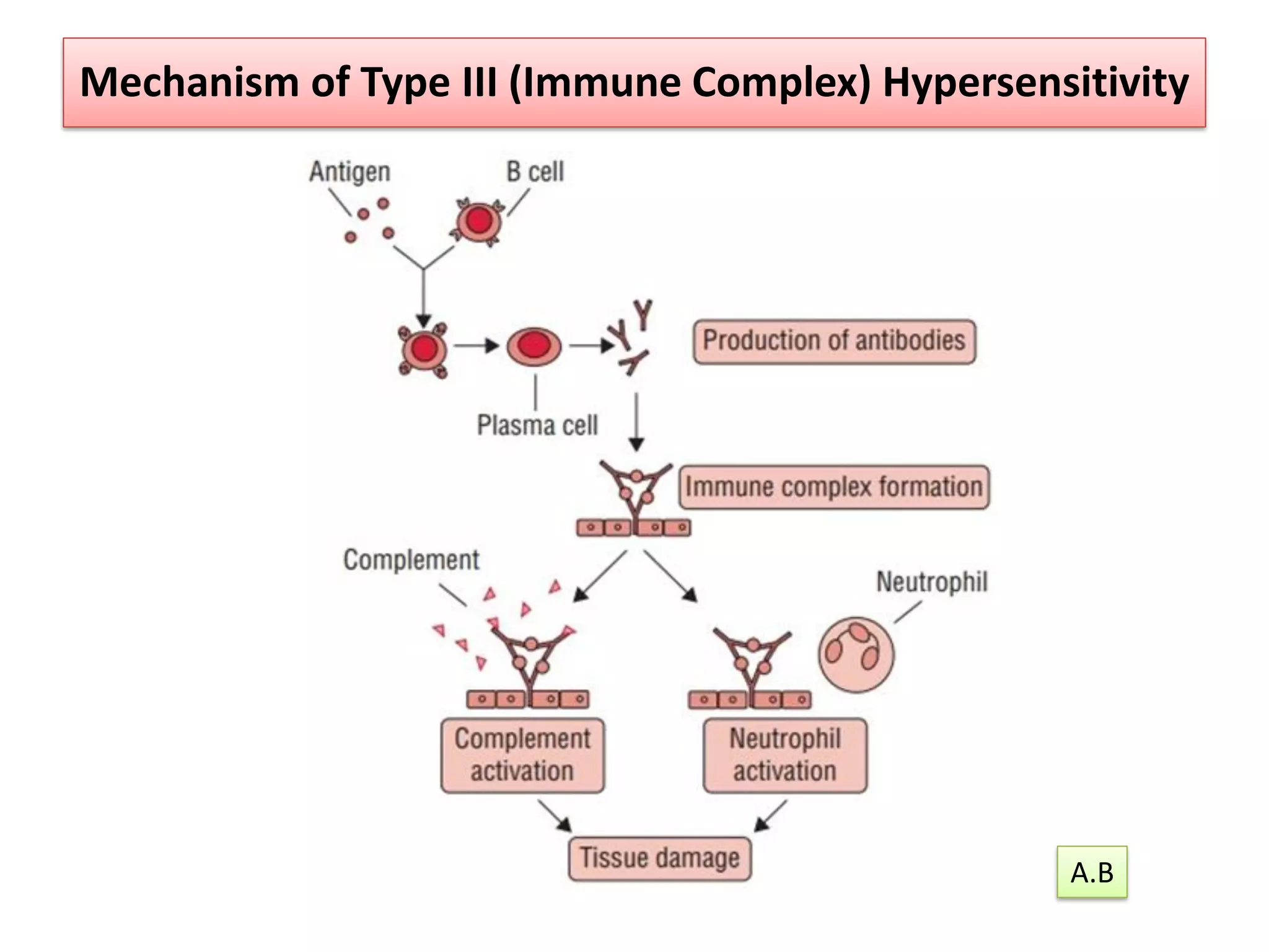 Type III Hypersensitivity | PDF