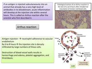 Type III Hypersensitivity | PDF