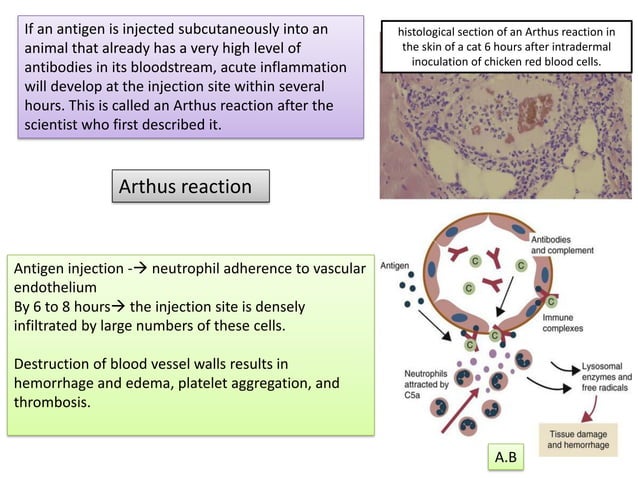 Type III Hypersensitivity | PDF | Blood Disorders | Diseases and Conditions