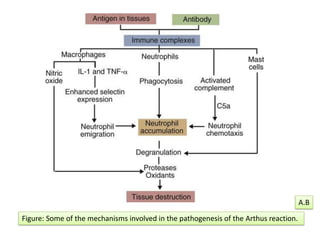 Type III Hypersensitivity | PDF