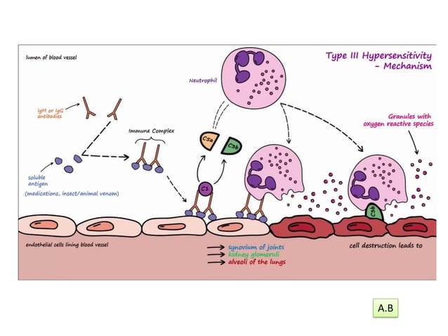 Type III Hypersensitivity | PDF | Blood Disorders | Diseases and Conditions