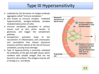 Type III Hypersensitivity | PDF