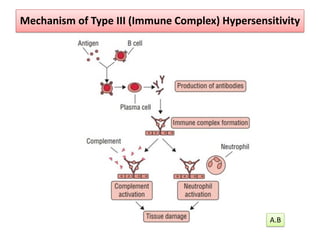 Type III Hypersensitivity | PDF
