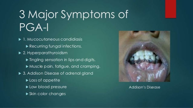 Type i polyglandular autoimmune syndrome