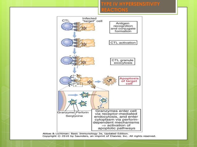 Type iv hypersensitivity reactions | PPTX