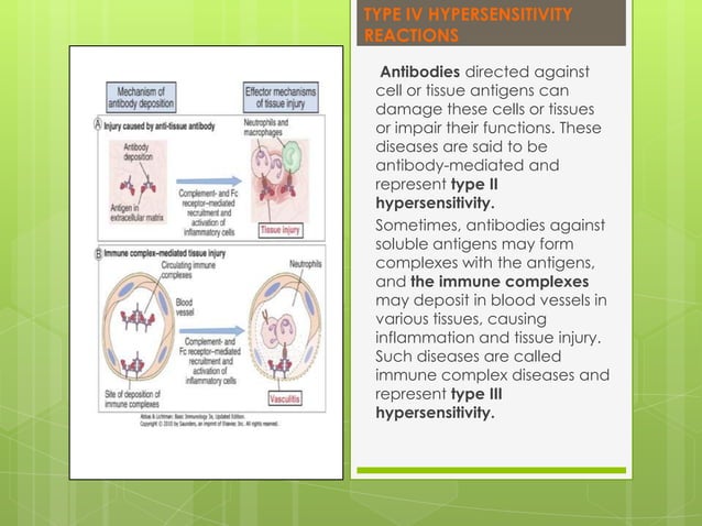 Type iv hypersensitivity reactions | PPTX