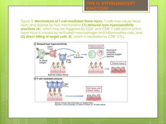 Type iv hypersensitivity reactions | PPTX
