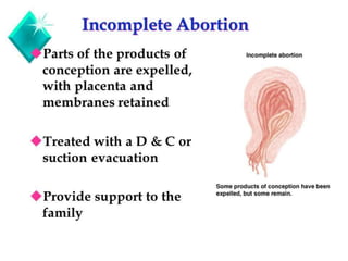 Type Of Abortion. | PPTX | Debated Sensitive Social Issues | Sensitive ...