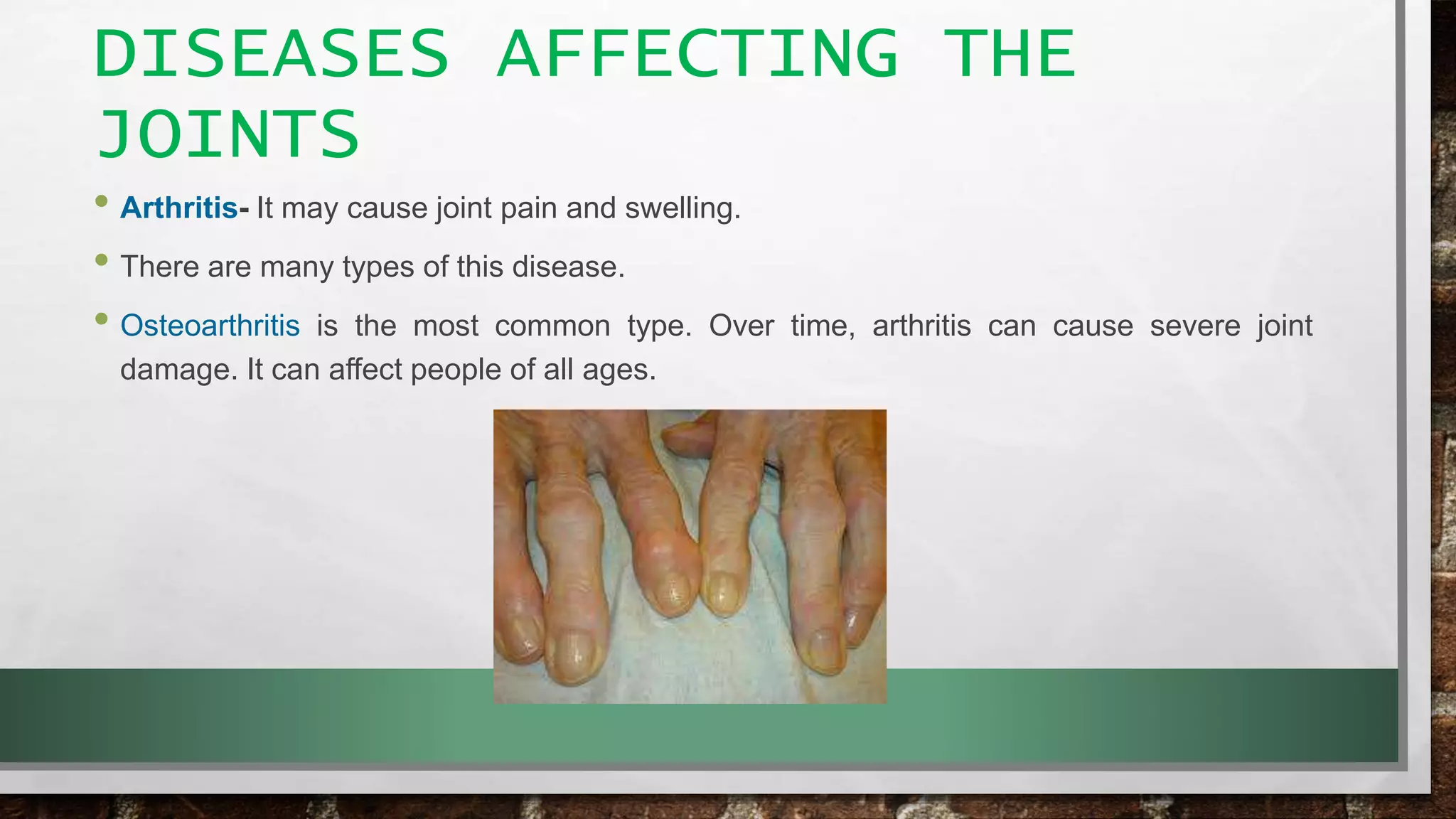 type of joint disorders.pptx
