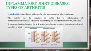 type of joint disorders.pptx