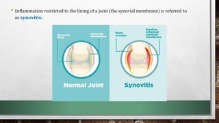 type of joint disorders.pptx
