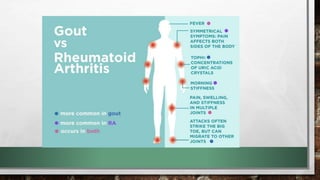 type of joint disorders.pptx
