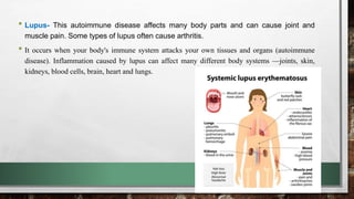 type of joint disorders.pptx
