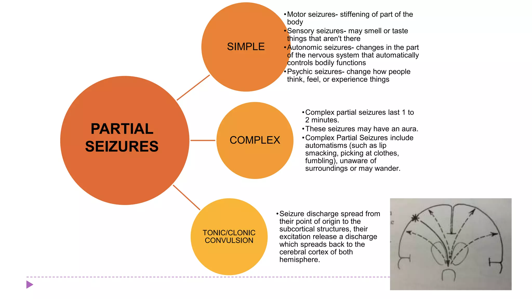 Type of seizures | PPTX