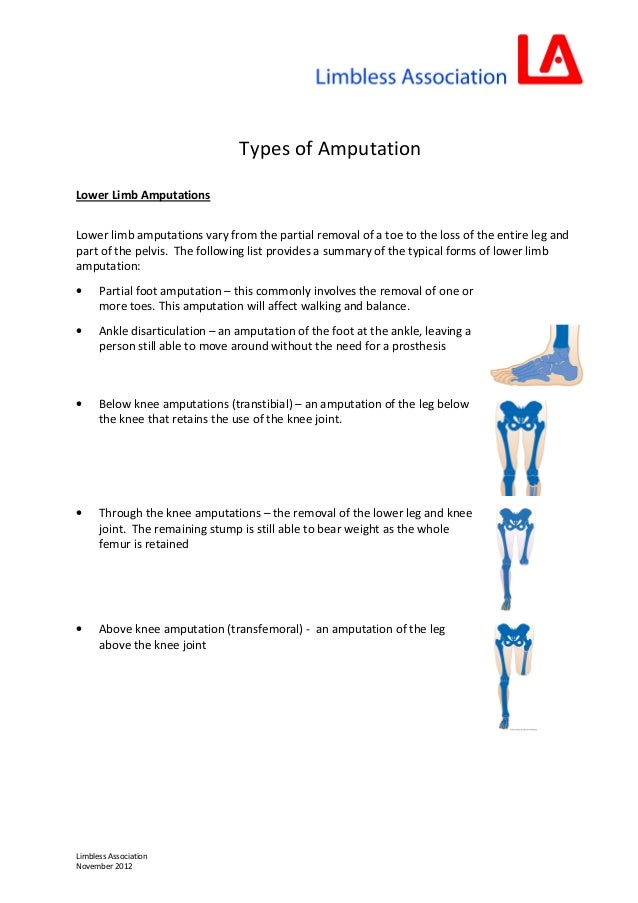 Types of-amputation (my care prosthetics and orthotics)
