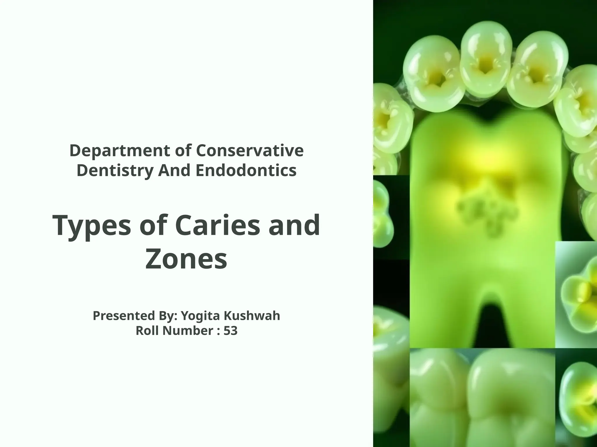 Types-of-Caries-and-Zones-of-Caries.pptx