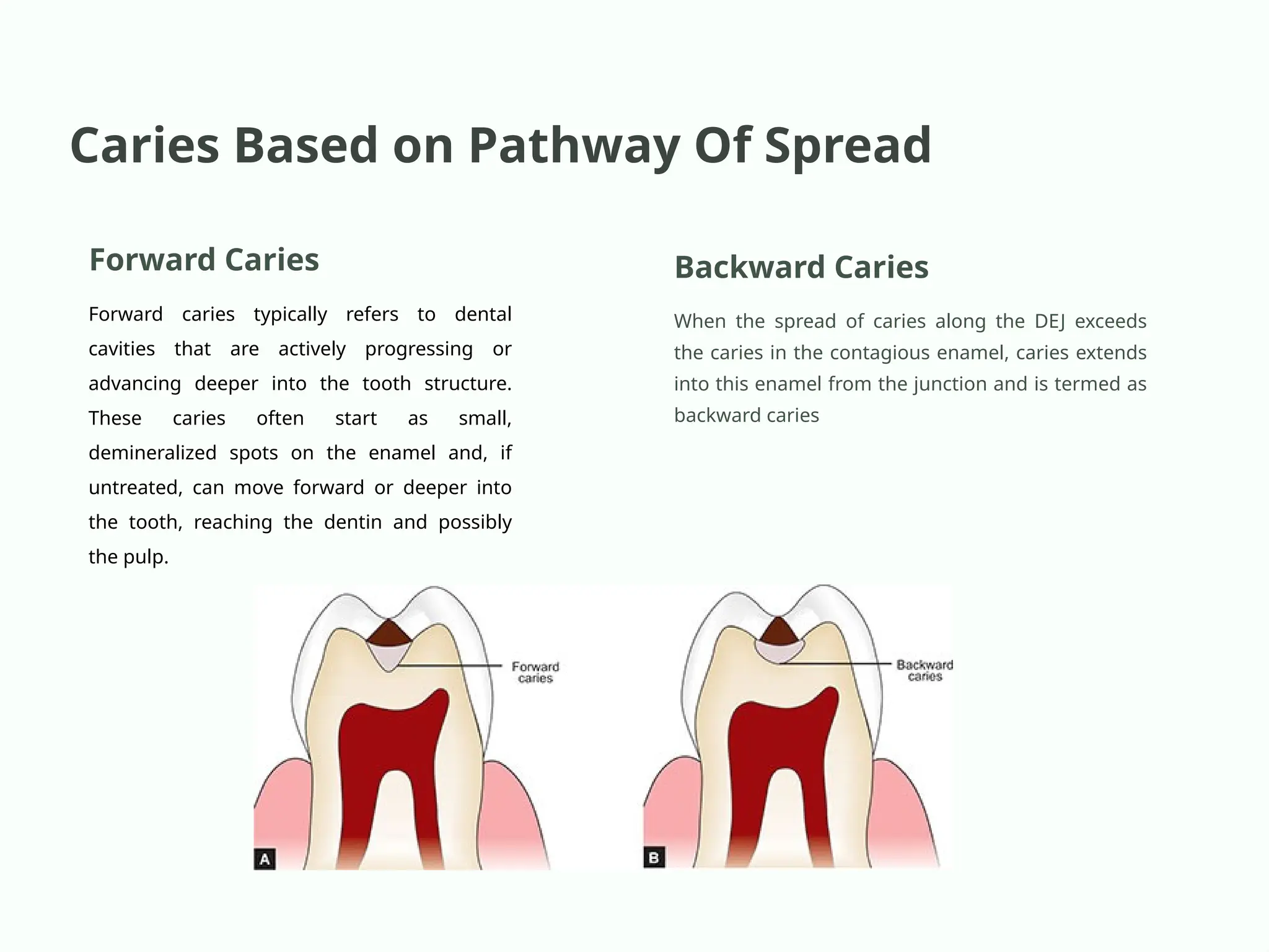 Types-of-Caries-and-Zones-of-Caries.pptx