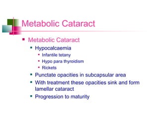 Types of Cataract (Part-II)19-05-2008.ppt