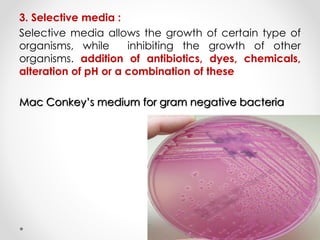 Types-of-culture-media in microbiology pdf | PDF