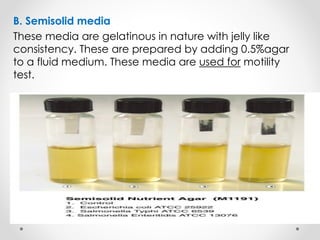 Types-of-culture-media in microbiology pdf | PDF