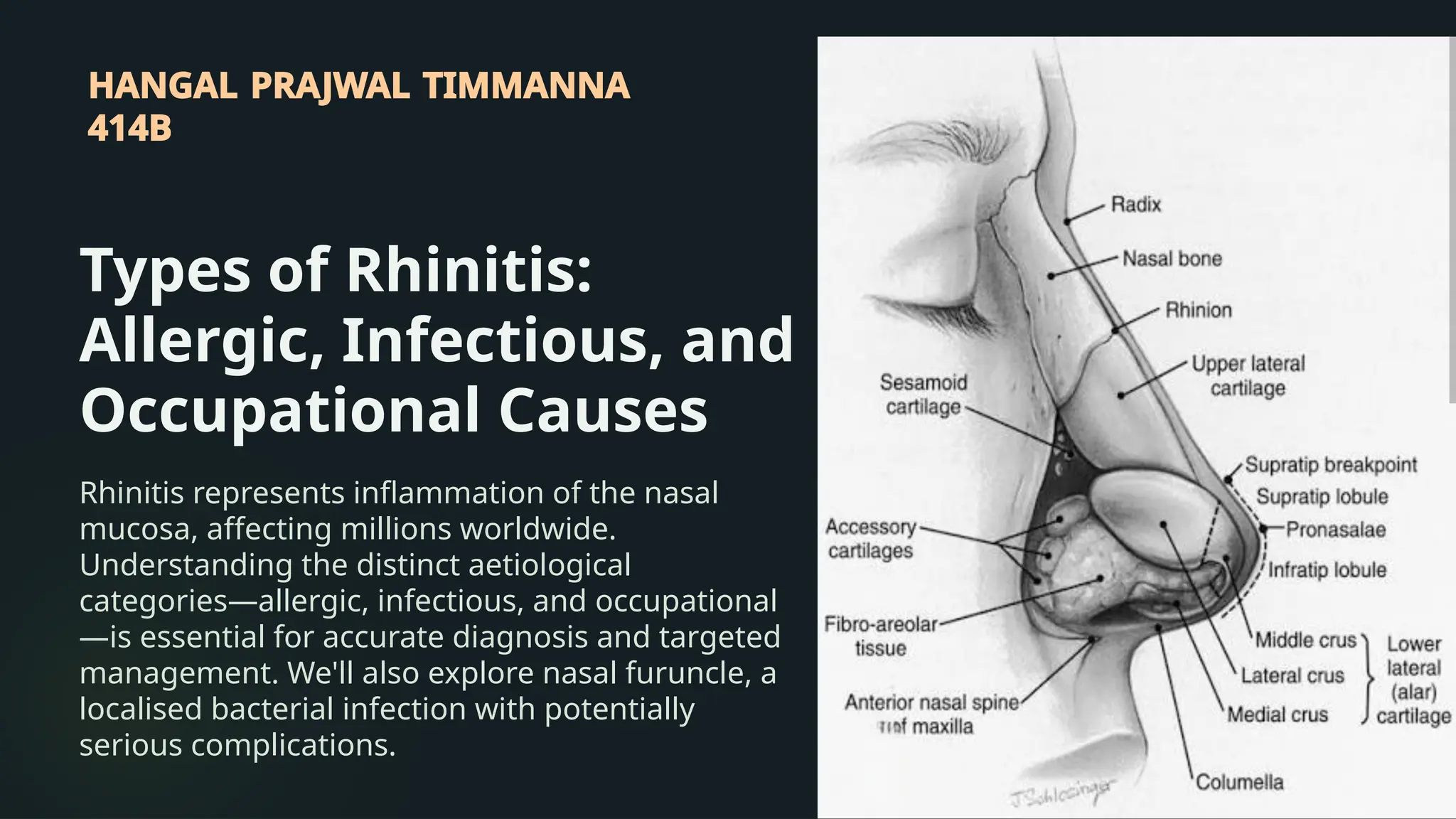 Types-of-Rhinitis-Allergic-Infectious-and-Occupational-Causes.pptx