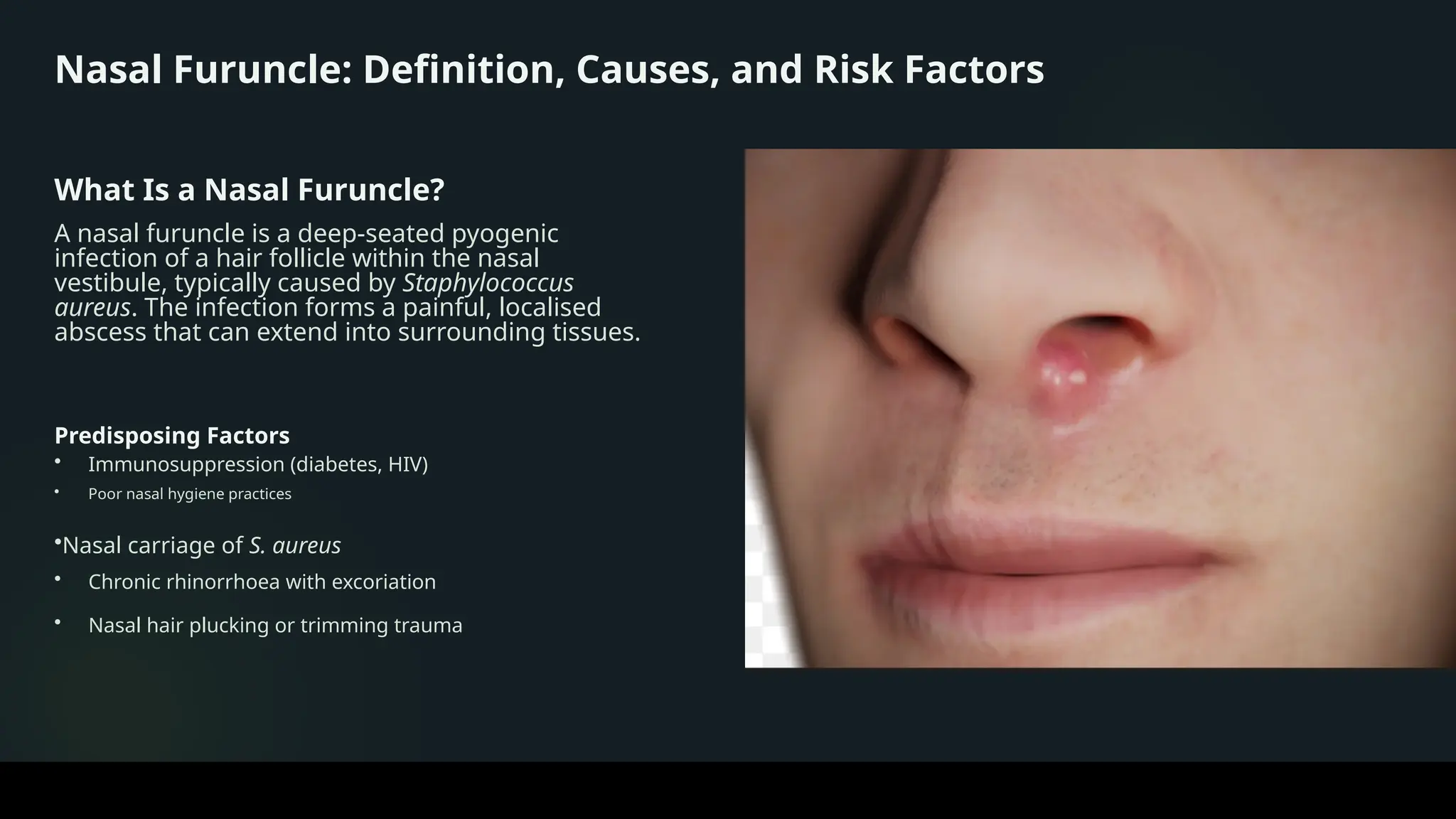 Types-of-Rhinitis-Allergic-Infectious-and-Occupational-Causes.pptx