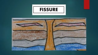 TYPES OF VOLCANOES BASED ON THEIR SHAPES | PPTX