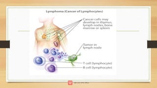 Types and classification of cancer | PDF