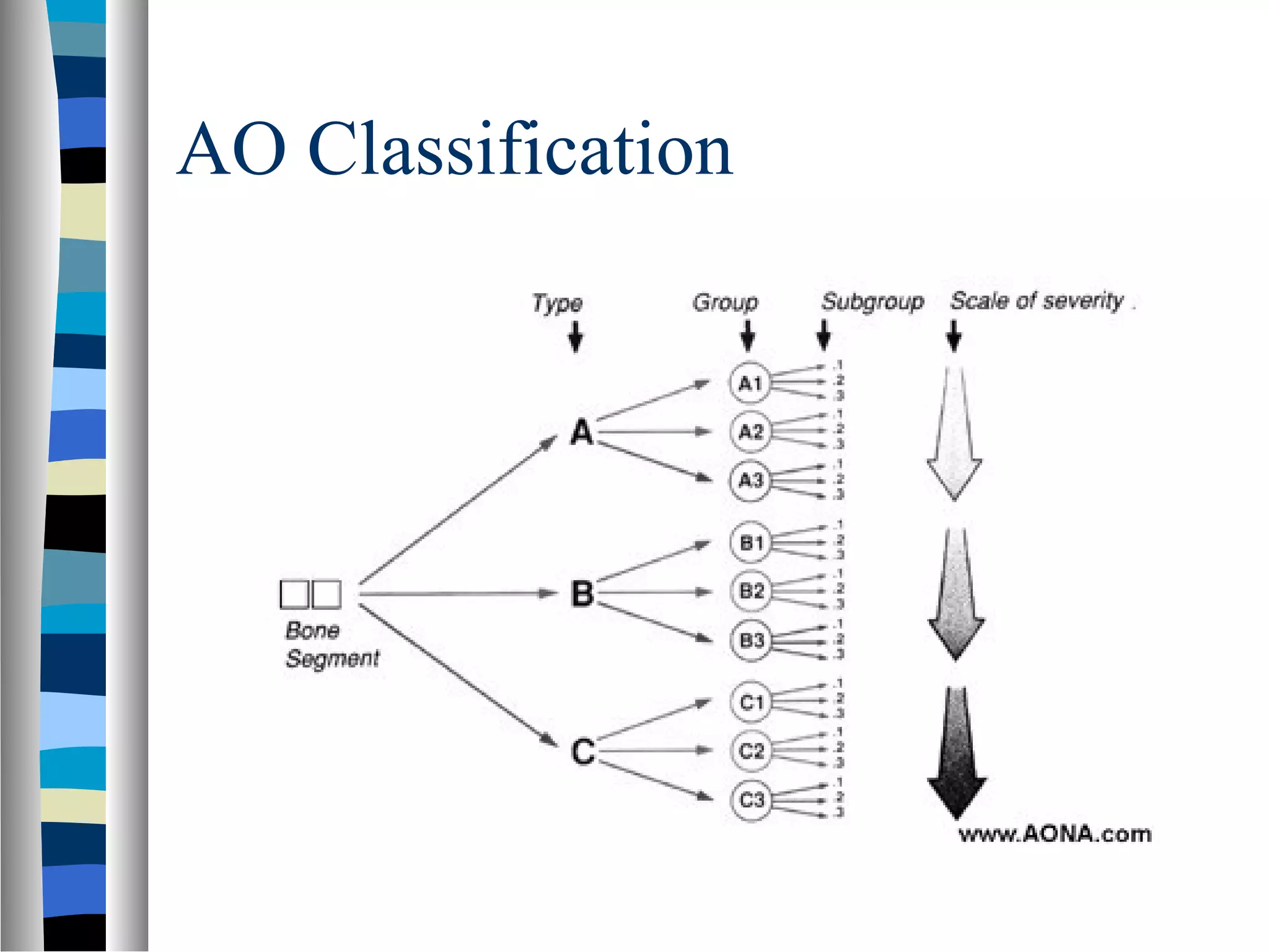 Types and classification of fractures | PPT