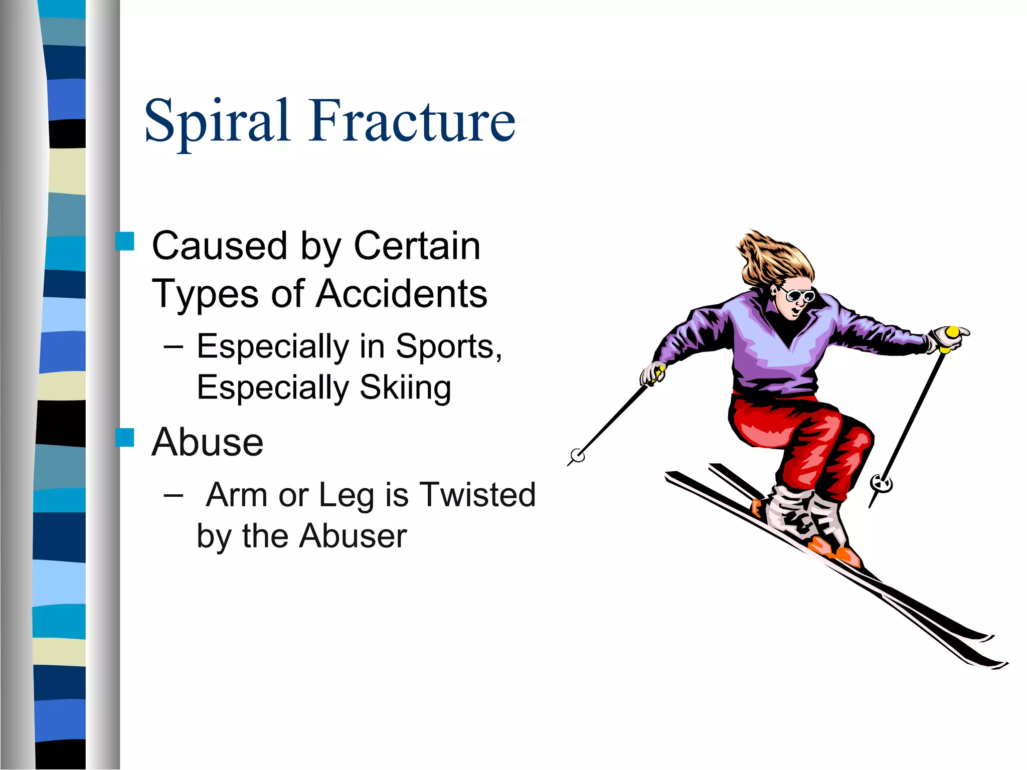 Types and classification of fractures | PPT
