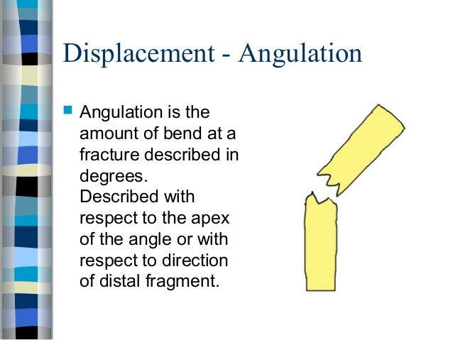 Types and classification of fractures