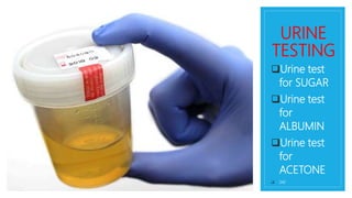 TYPES AND COLLECTION OF URINE SPECIMEN.pptx