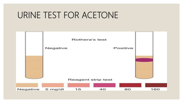 TYPES AND COLLECTION OF URINE SPECIMEN.pptx
