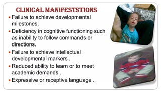 types and prevention of Mental Retardation.pptx