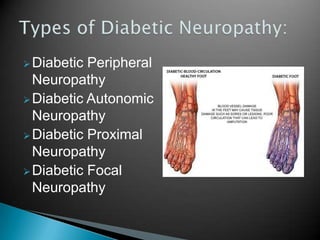 Types and Symptoms of Diabetic Neuropathy | PPTX