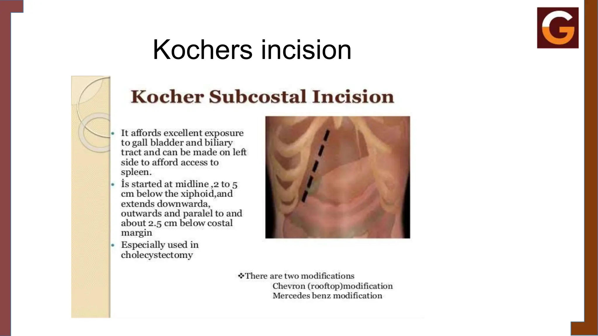 Types of abdominal surgeries and types of abdominal incisions.pptx