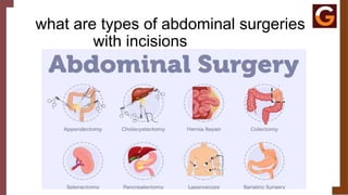 Types of abdominal surgeries and types of abdominal incisions.pptx