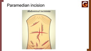 Types of abdominal surgeries and types of abdominal incisions.pptx