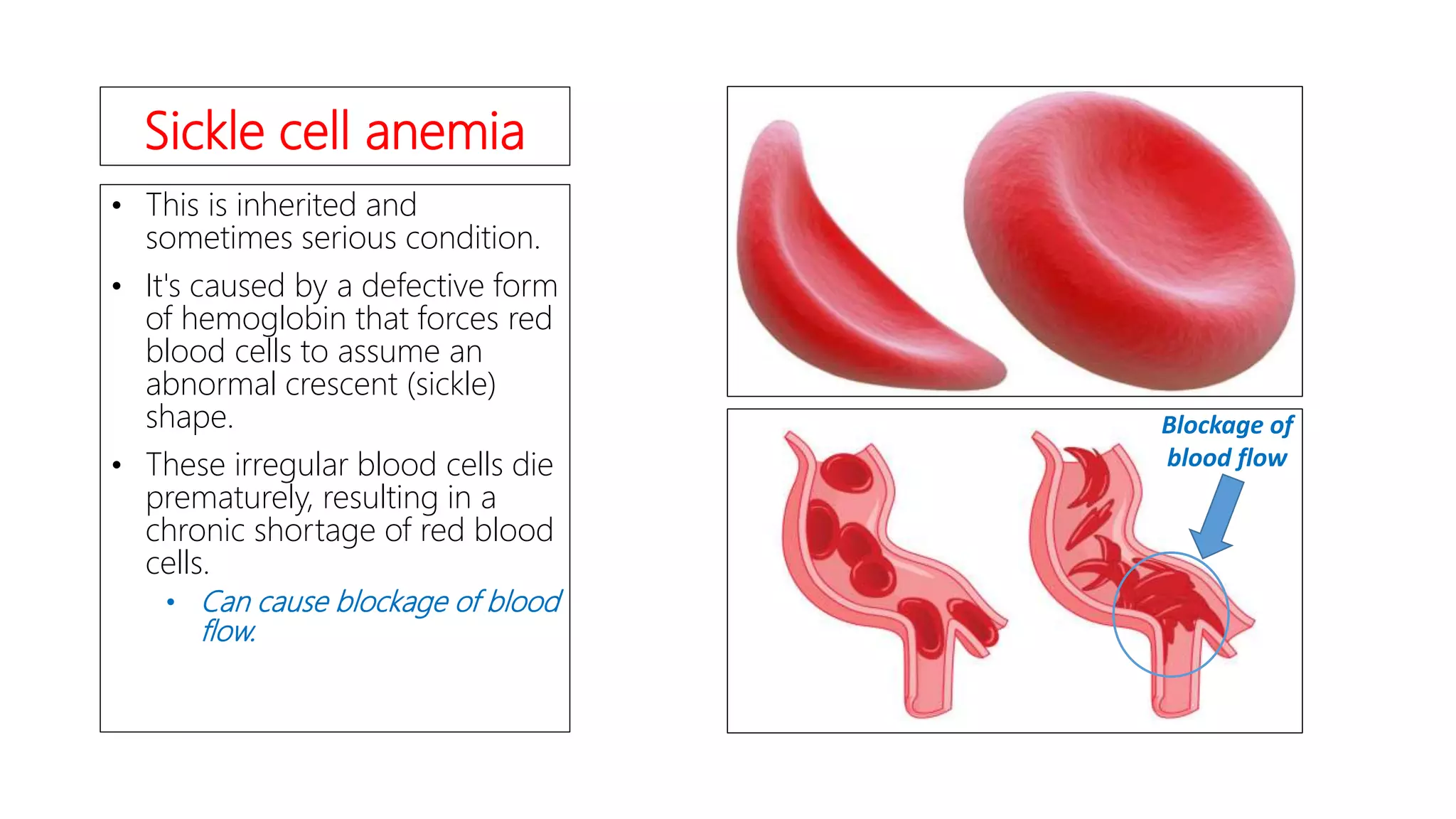 Types of anemia | PPTX