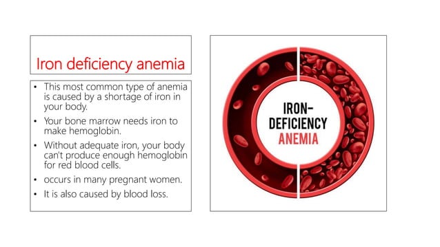 Types of anemia | PPTX | Blood Disorders | Diseases and Conditions