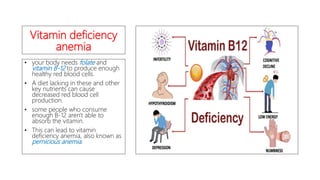 Types of anemia | PPTX