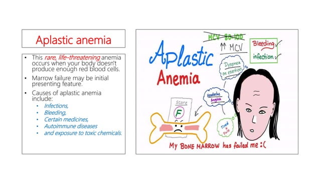 Types of anemia | PPTX | Blood Disorders | Diseases and Conditions