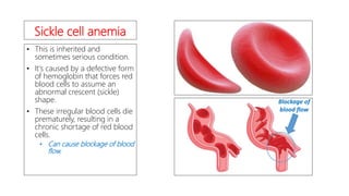Types of anemia | PPTX